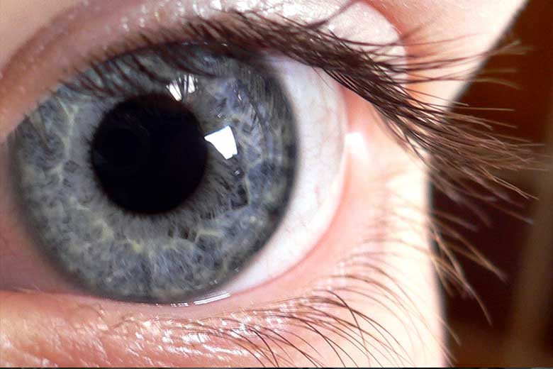 Degeneracija makule - Terrapromo